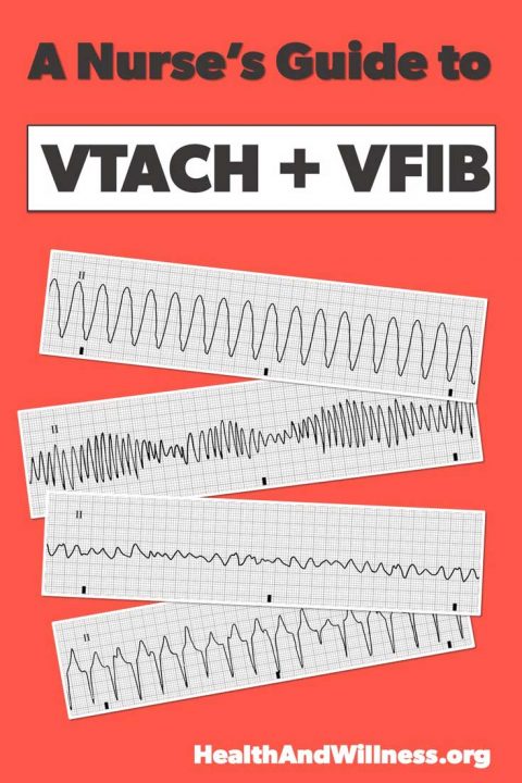VTACH + VFIB | A Nurse’s Guide to Ventricular Arrhythmias | Health And ...