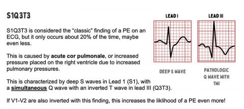Pulmonary Embolism: Nurse’s Reference Guide | Health And Willness