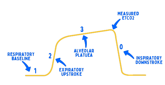 Nurses Guide to Lung Auscultation of lung sounds and the comprehensive ...